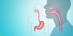 Top Treatment Options for Achalasia: From Medication to Surgery ...